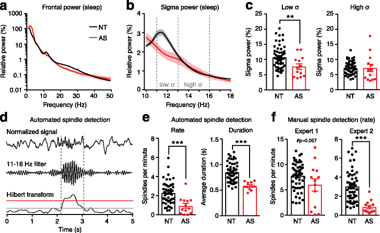 Abnormal coherence and sleep composition in children with Angelman ...