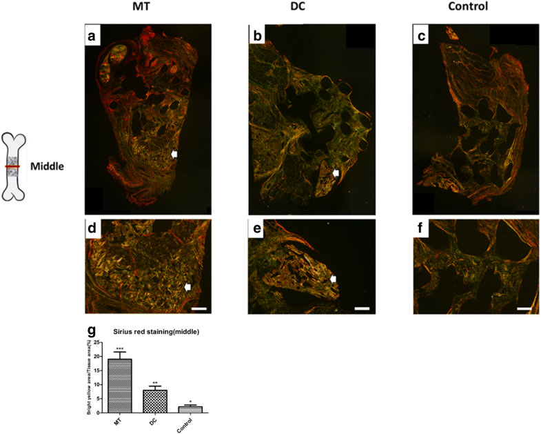 Development of a micro-tissue-mediated injectable bone tissue ...