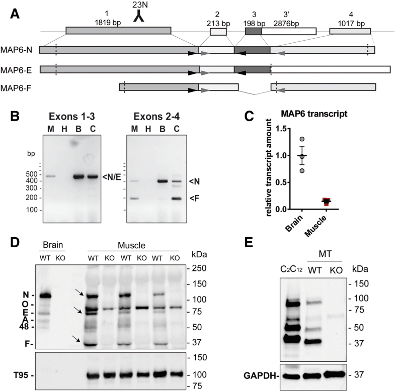 Deletion of the microtubule-associated protein 6 (MAP6) results in ...