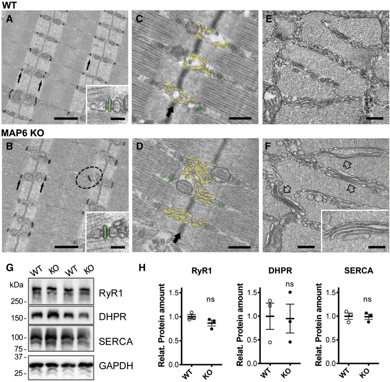 Deletion of the microtubule-associated protein 6 (MAP6) results in ...