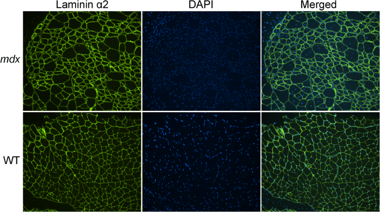 Automated muscle histopathology analysis using CellProfiler | Skeletal Muscle | Full Text
