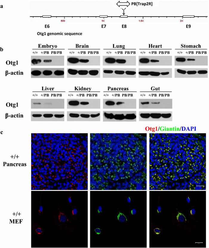 Disruption of the Golgi protein Otg1 gene causes defective hormone secretion and aberrant ...