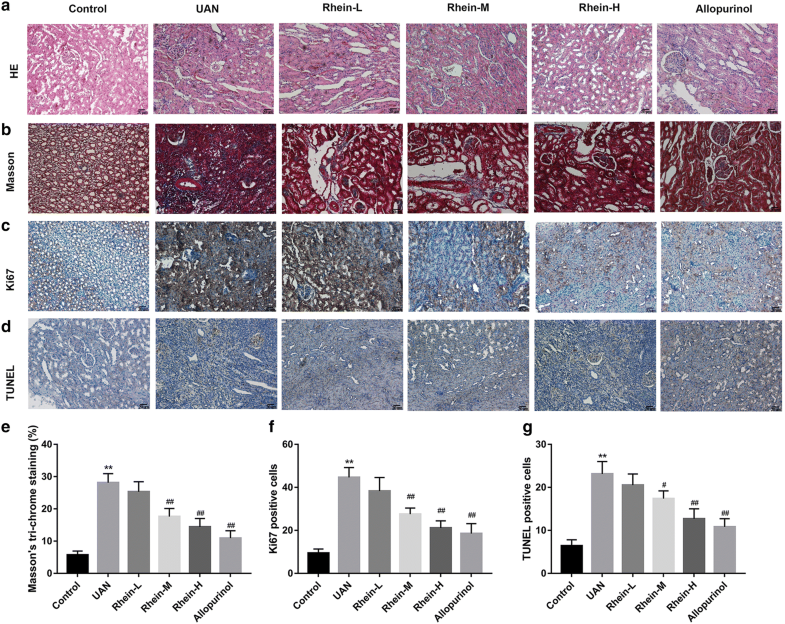 Long non-coding RNA ANRIL-mediated inflammation response is involved in ...