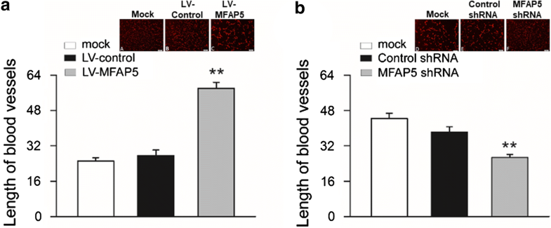 MFAP5 promotes basal-like breast cancer progression by activating the ...