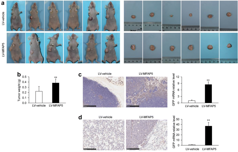 MFAP5 promotes basal-like breast cancer progression by activating the ...