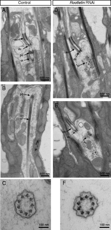 The Drosophila homologue of Rootletin is required for mechanosensory ...