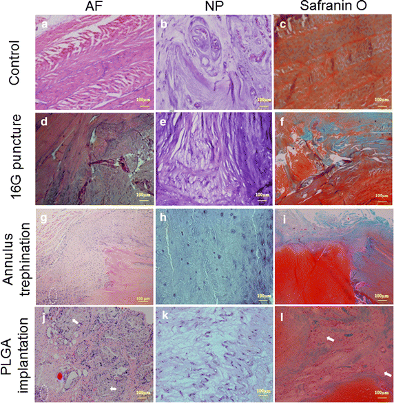 Minimal invasive annulotomy for induction of disc degeneration and ...