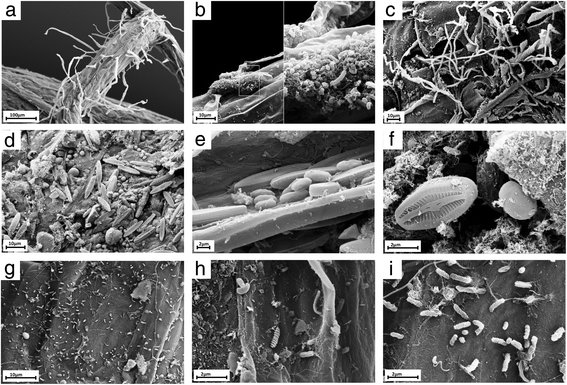 Microbial interactions within the plant holobiont | Microbiome | Full Text