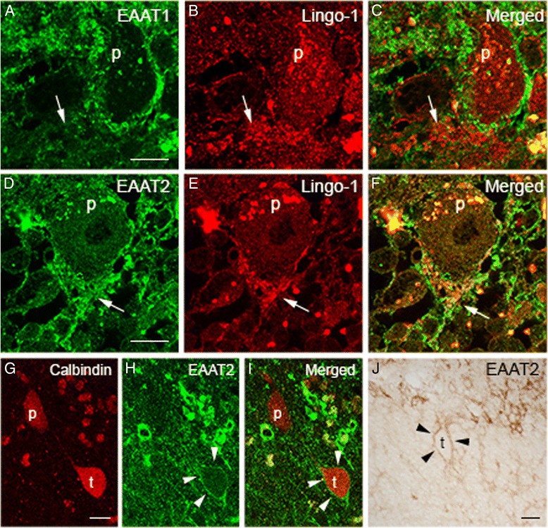 Decreased EAAT2 protein expression in the essential tremor cerebellar ...