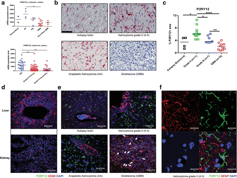 Expression site of P2RY12 in residential microglial cells in ...