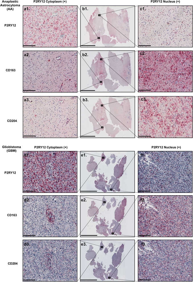 Expression site of P2RY12 in residential microglial cells in ...