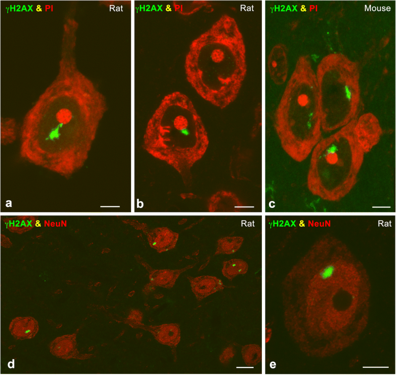 Persistent accumulation of unrepaired DNA damage in rat cortical ...