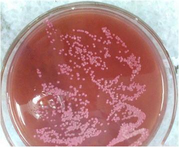Occurrence and antimicrobial susceptibility profile of Escherichia coli ...