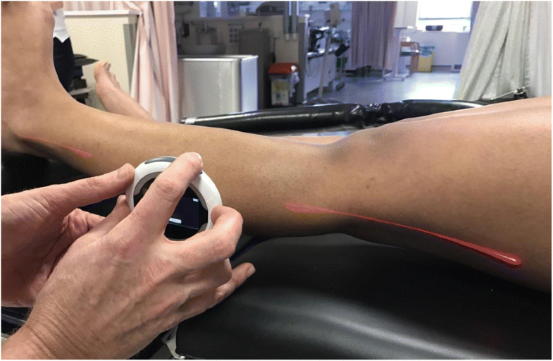 Accuracy and reliability of knee goniometry methods | Journal of ...