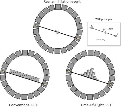 Recent developments in time-of-flight PET | EJNMMI Physics | Full Text