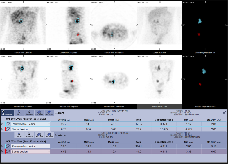 Quantitative SPECT: the time is now | EJNMMI Physics | Full Text