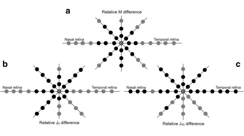Relative peripheral refraction across 4 meridians after orthokeratology ...