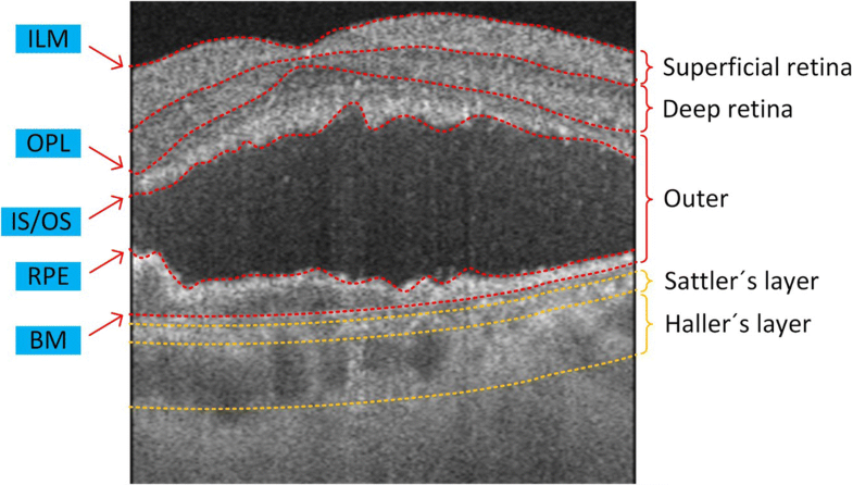 Comparing imaging capabilities of spectral domain and swept source ...
