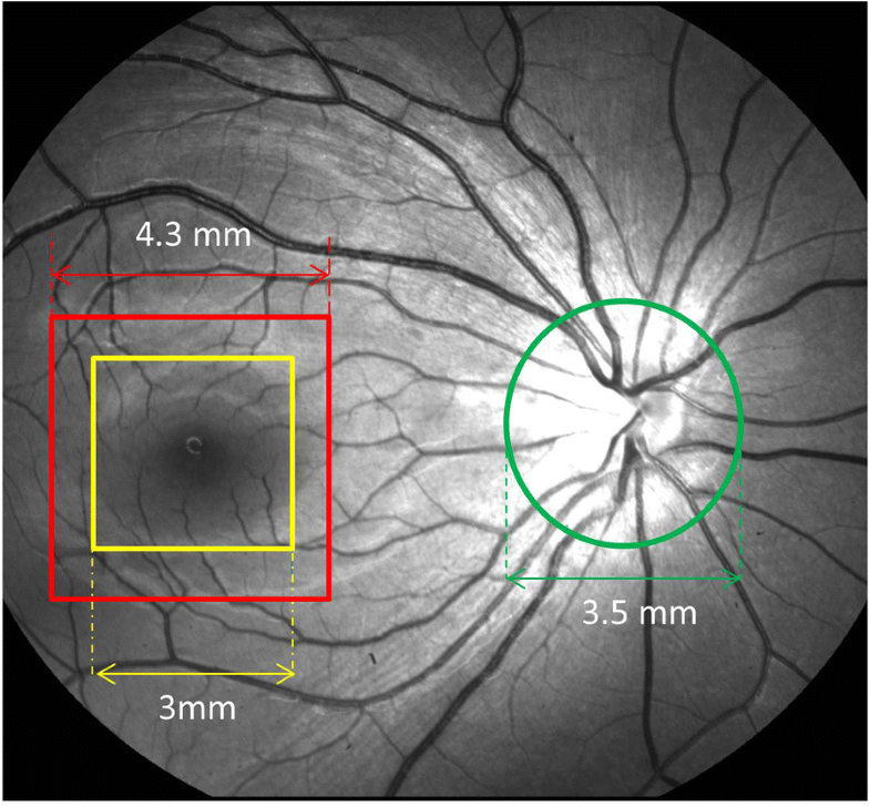 Retinal nerve fiber layer (RNFL) integrity and its relations to retinal ...