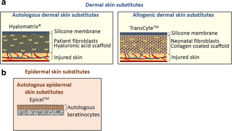 Development and use of biomaterials as wound healing therapies | Burns ...