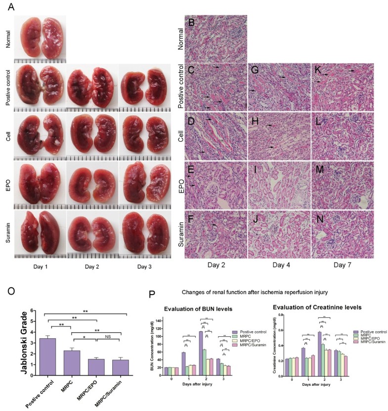 Improving outcomes of acute kidney injury using mouse renal progenitor ...