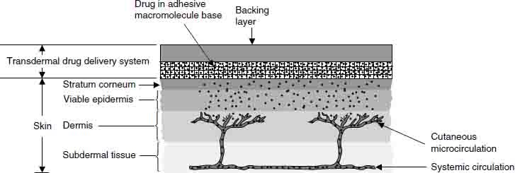 Fentanyl Transdermal Matrix Patch (Durotep® MT Patch; Durogesic® DTrans ...