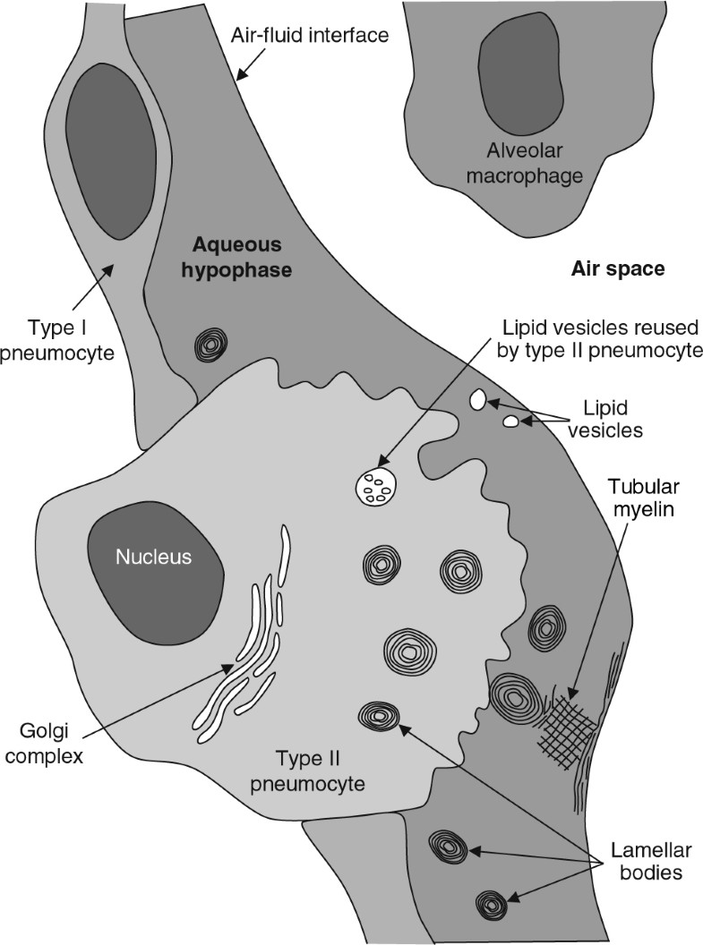 Pathophysiology of Neonatal Respiratory Distress Syndrome | SpringerLink