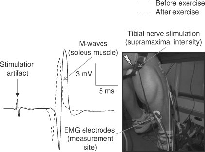 Repeated-Sprint Ability — Part I | SpringerLink
