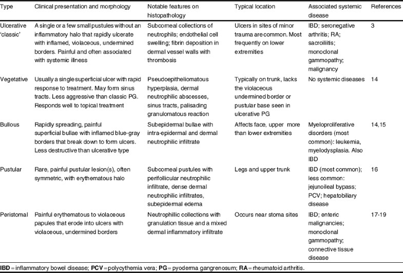 Etiology and Management of Pyoderma Gangrenosum | SpringerLink