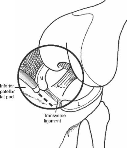 Evaluation and Treatment of Disorders of the Infrapatellar Fat Pad ...