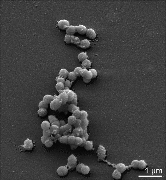 Erratum to: Complete genome sequence of Atopobium parvulum type strain ...