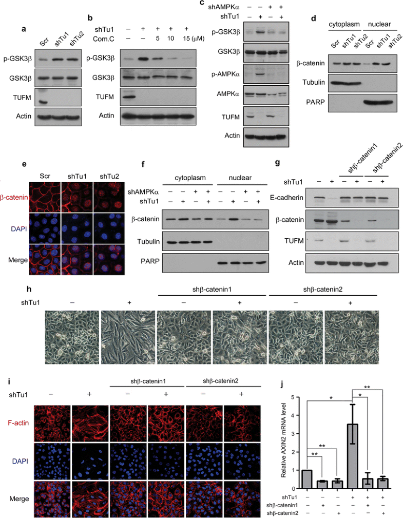 TUFM downregulation induces epithelial–mesenchymal transition and ...