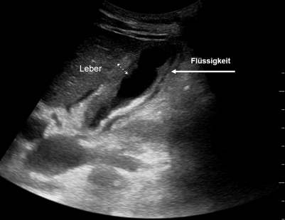 Strukturierte bettseitige Sonographie in der Intensivmedizin | SpringerLink