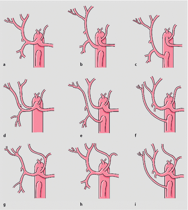 Technik der Leberresektion | SpringerLink