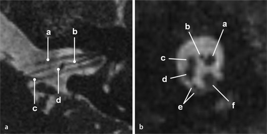 Computer- und Magnetresonanztomographie des N. facialis | SpringerLink