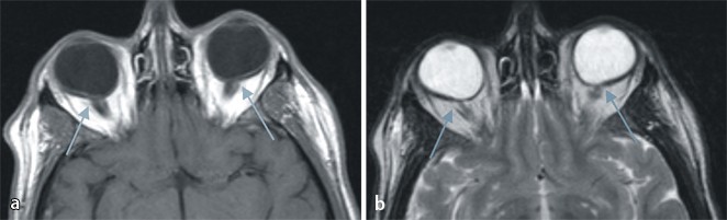 Orbita – Anatomie, Entwicklung und Fehlbildungen | SpringerLink
