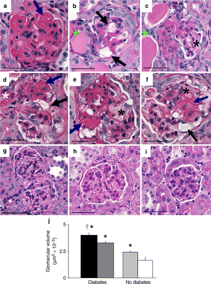 Podocyte vascular endothelial growth factor ( Vegf164) overexpression ...