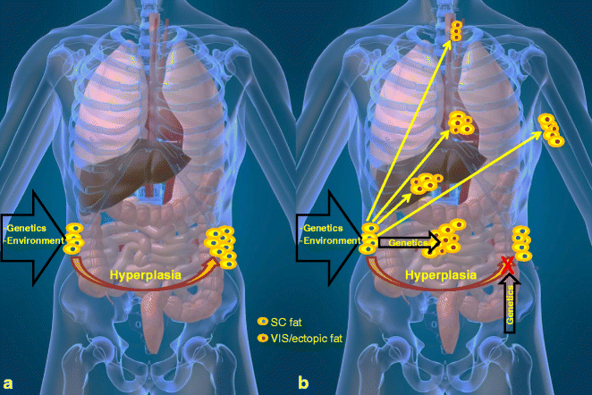 The genetics of fat distribution | SpringerLink