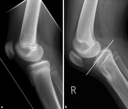 Die großen Apophysen | SpringerLink