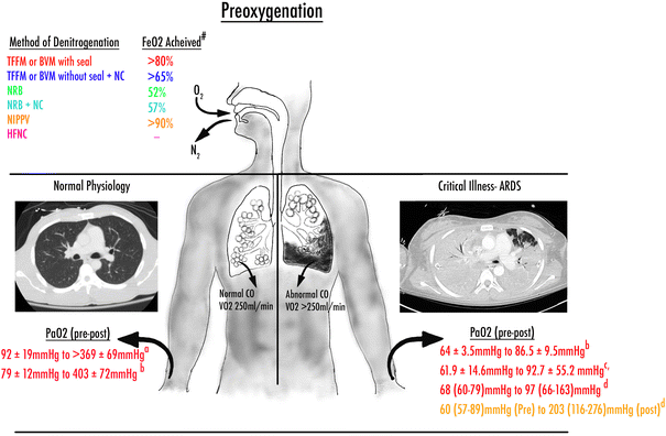 Understanding preoxygenation and apneic oxygenation during intubation ...