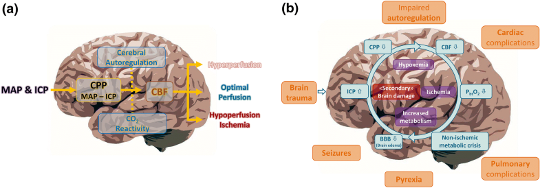 Intracranial pressure thresholds in severe traumatic brain injury: Con ...