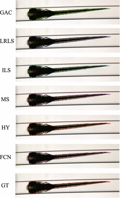 An efficient and robust hybrid method for segmentation of zebrafish objects from bright-field ...