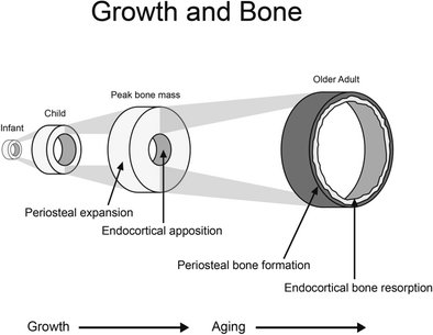 The National Osteoporosis Foundation’s position statement on peak bone ...
