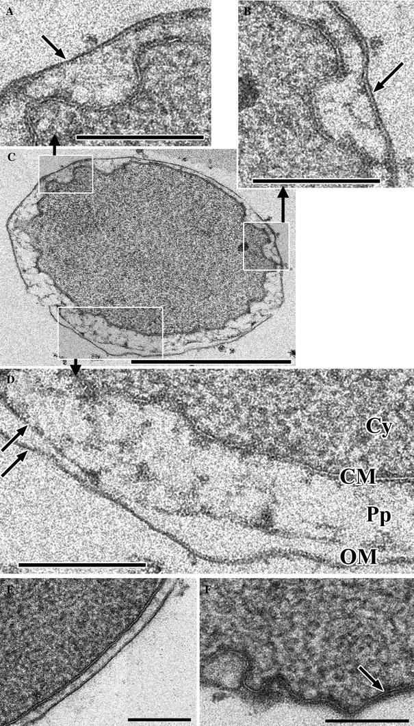Ignicoccus hospitalis and Nanoarchaeum equitans: ultrastructure, cell ...