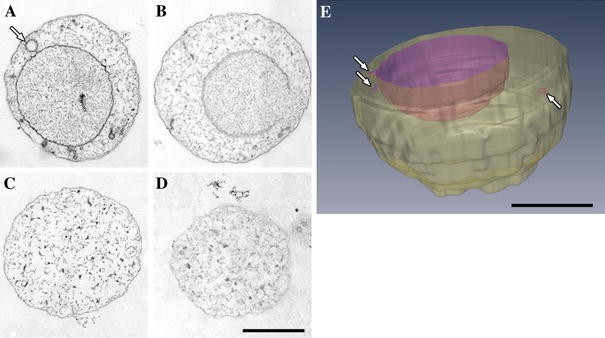 Ignicoccus hospitalis and Nanoarchaeum equitans: ultrastructure, cell ...