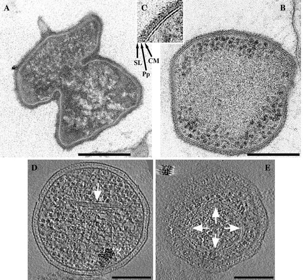 Ignicoccus hospitalis and Nanoarchaeum equitans: ultrastructure, cell ...