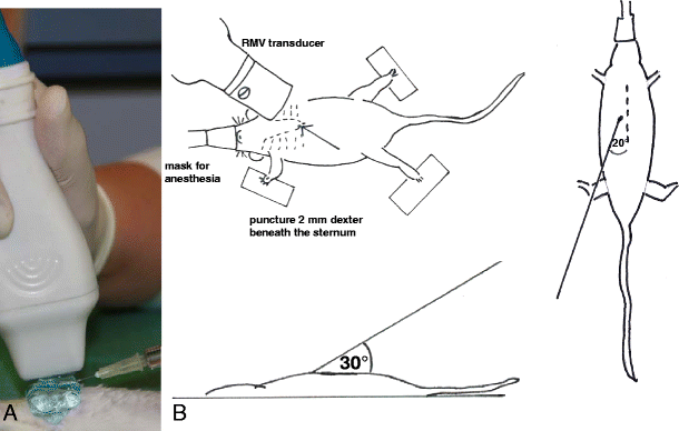 Minimally invasive closed-chest ultrasound-guided substance delivery ...