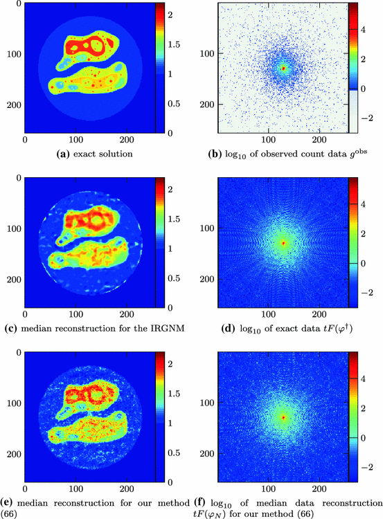 Iteratively regularized Newton-type methods for general data misfit functionals and applications ...