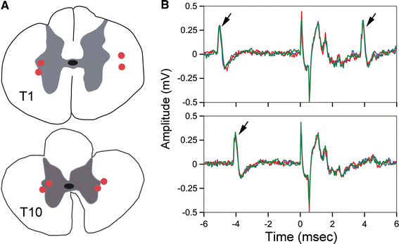 Role of the rostral ventrolateral medulla (RVLM) in the patterning of ...