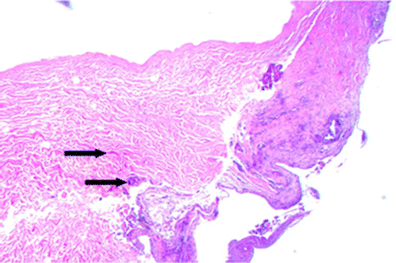 DermACELL: a novel and biocompatible acellular dermal matrix in tissue ...